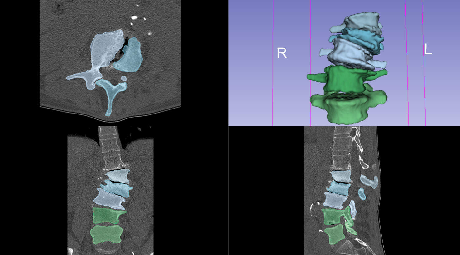 SpinePlanner - SpinePlanner